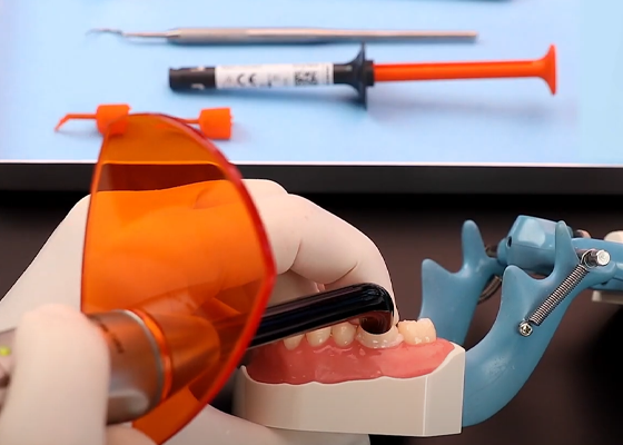 How to cement a zirconia crown with 3M™ RelyX™ Universal Resin Cement ...