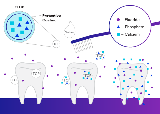 New approach: Functionalized Tri-calcium Phosphate (fTCP) | Solventum