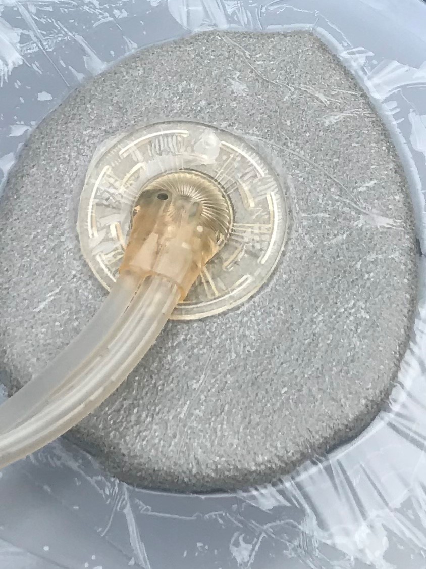 3M Veraflo Therapy | Solventum